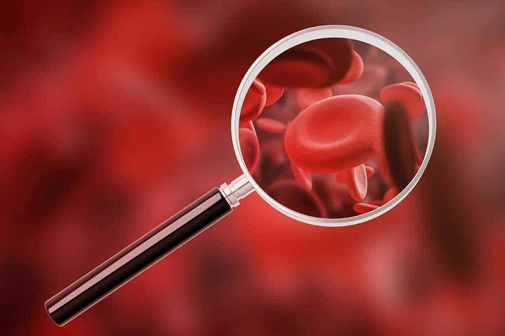 Volumen Corpuscular Medio qu Significa Mejor Con Salud Volumen Corpuscular Medio qu Significa Mejor Con Salud