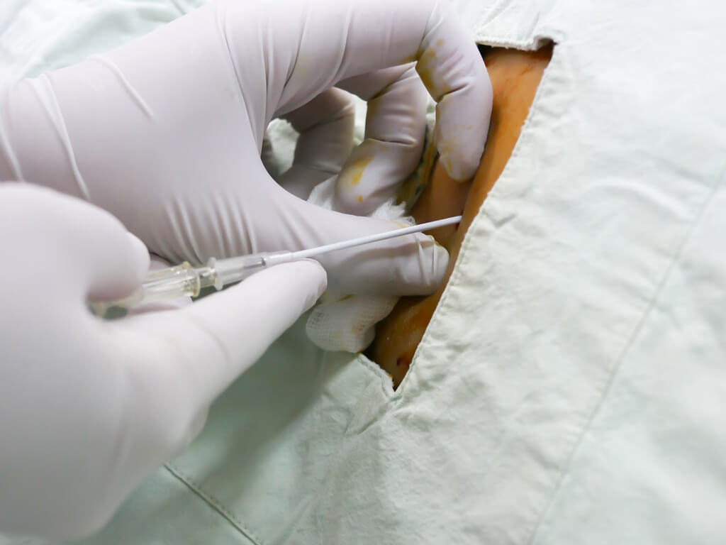 Síndrome de Allen-Masters - Mejor con Salud