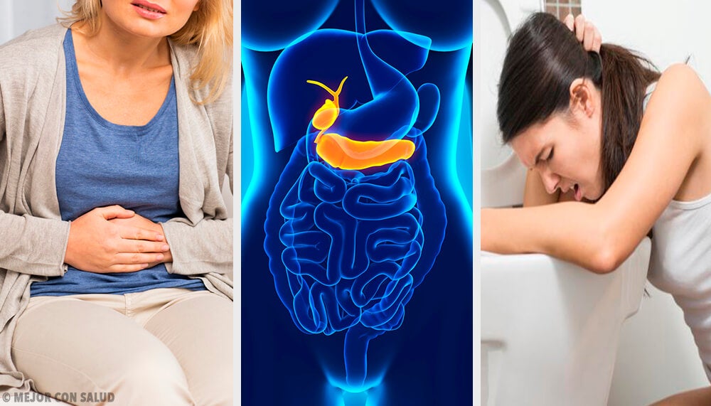 ¿Qué es la colecistitis? - Mejor con Salud