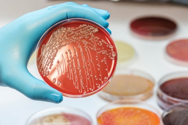 Escherichia coli: todo lo que debes saber - Mejor con Salud