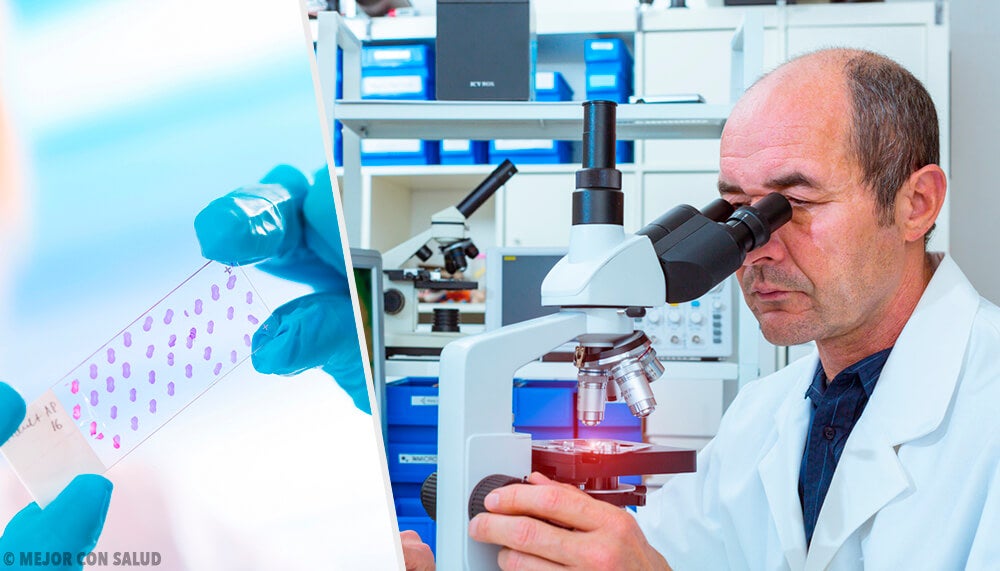 ¿En qué consiste una biopsia? - Mejor con Salud