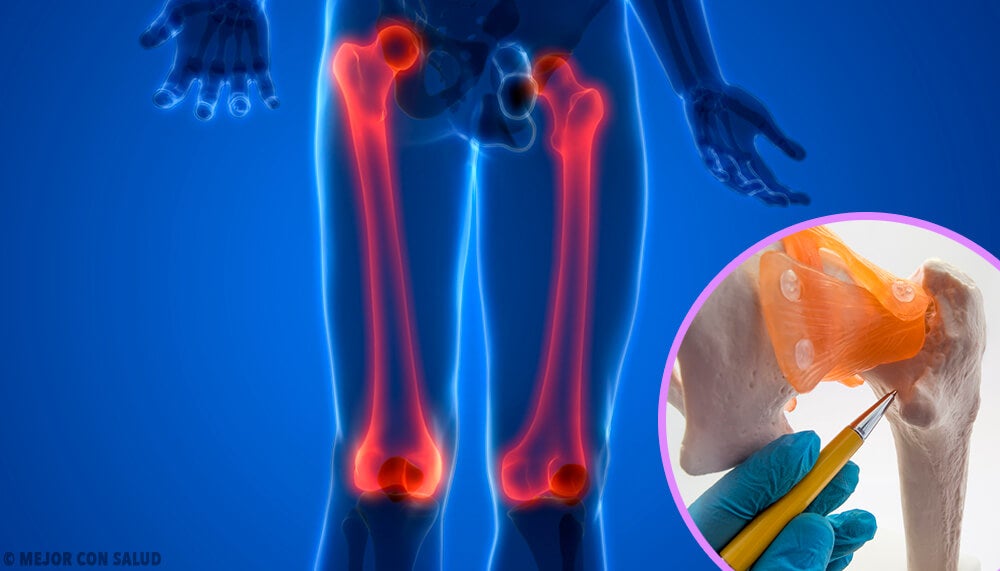 Enfermedad de Perthes: todo lo que debes saber - Mejor con Salud