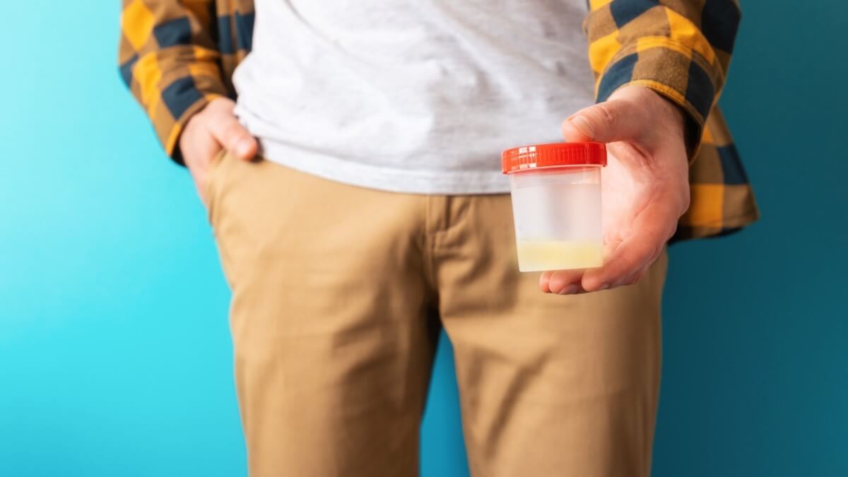 Semen amarillo, posibles causas y qué debes hacer - Mejor con Salud