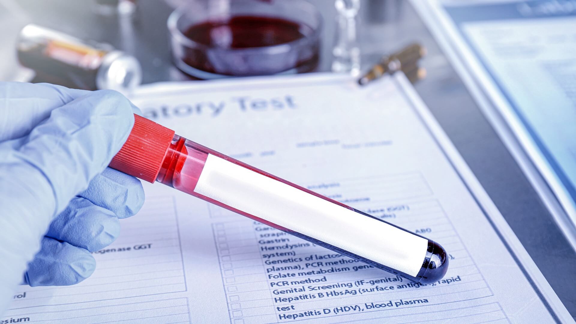 Eosinófilos altos o bajos, ¿por qué ocurre y qué hacer? - Mejor con Salud